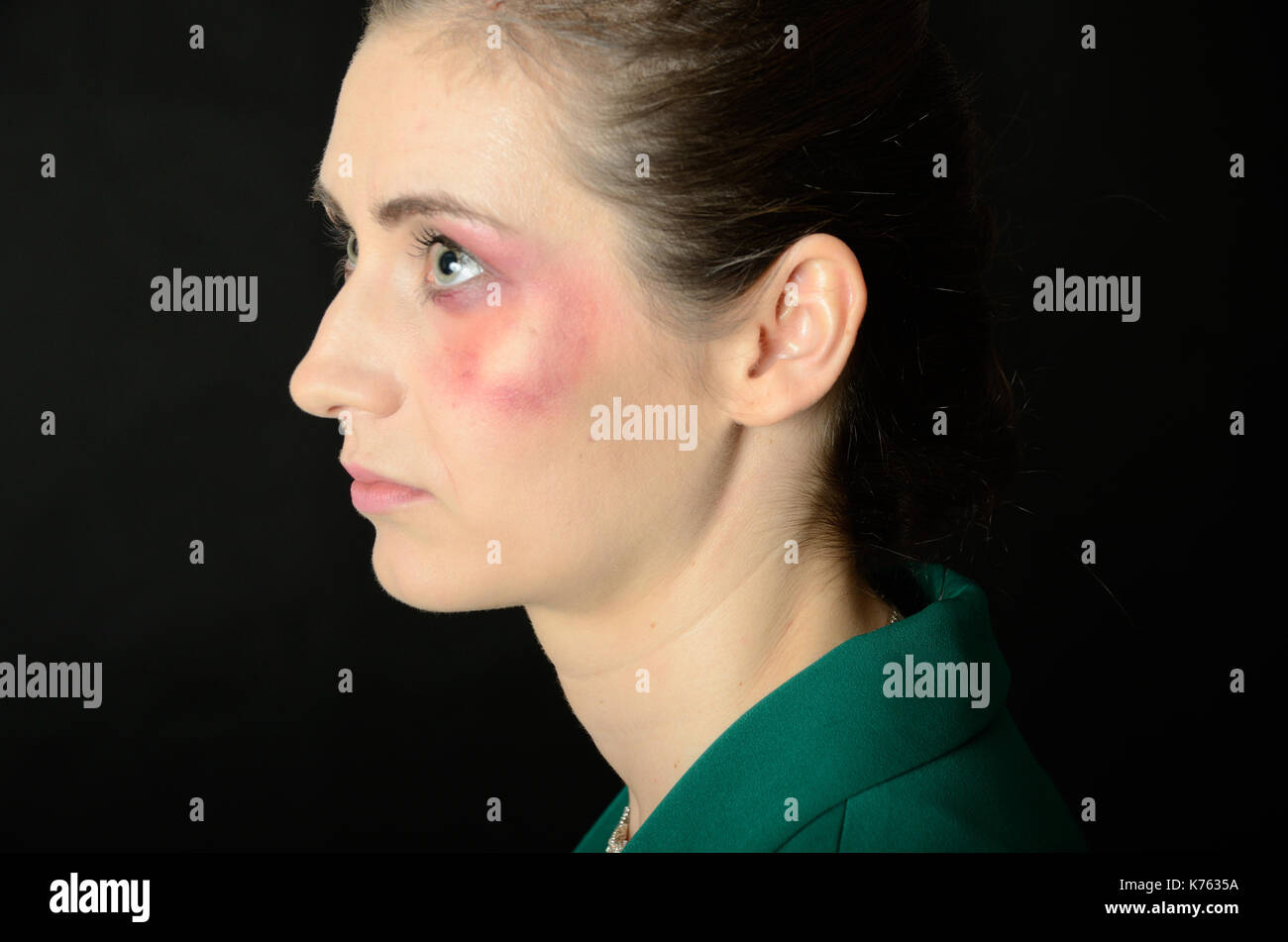 Hurted hi-res stock photography and images - Alamy