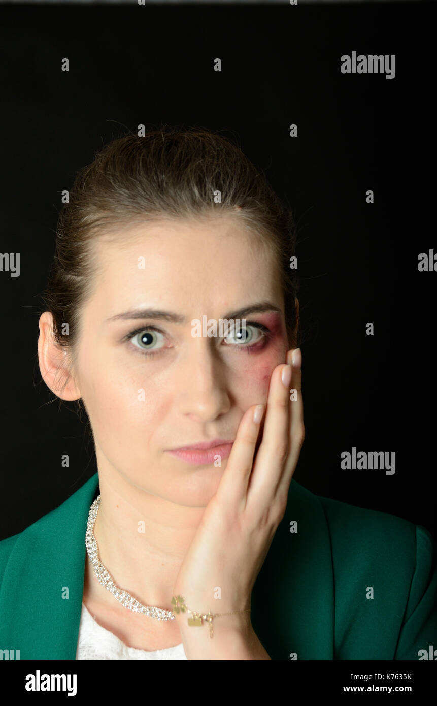 Hurted hi-res stock photography and images - Alamy