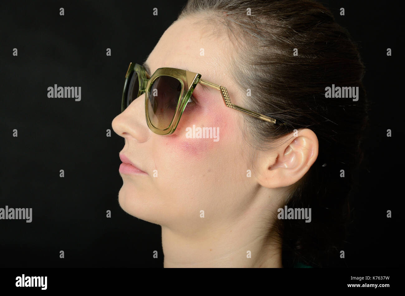 Home violence. Beaten woman with injuries on face, bleeding. Trying to ...