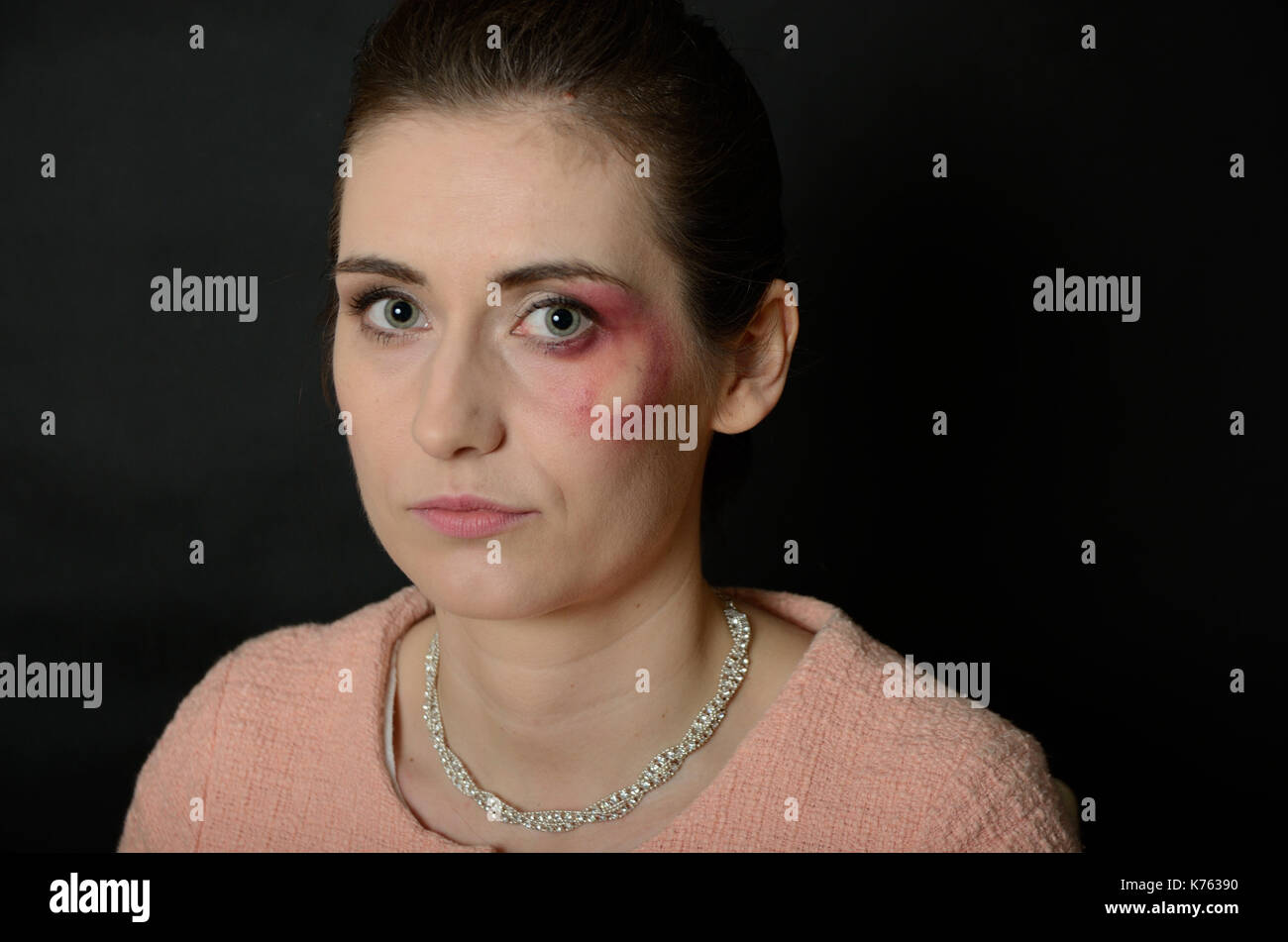 Home violence. Beaten woman with injuries on face, bleeding, black eye ...