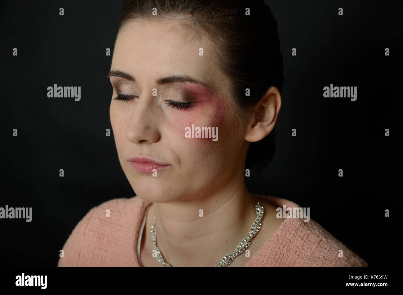 Hurted hi-res stock photography and images - Alamy