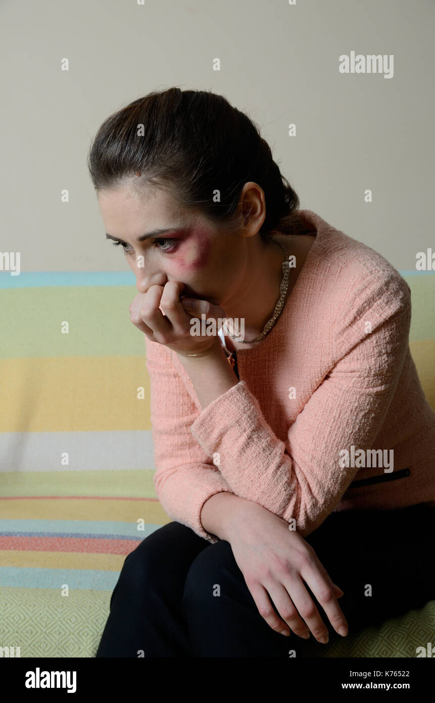 Home violence. Beaten woman with injuries on face, bleeding, black eye ...