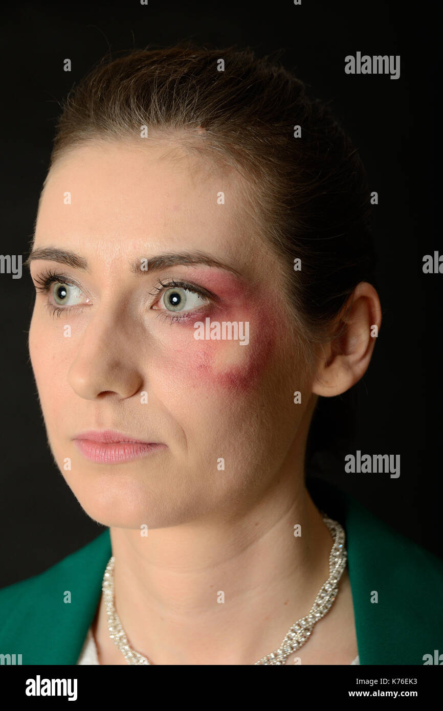 Home violence. Portrait of beaten woman with injuries on face, bleeding ...