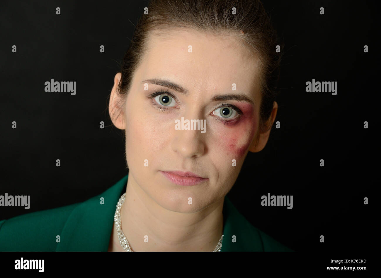 Home violence. Portrait of beaten woman with injuries on face, bleeding ...