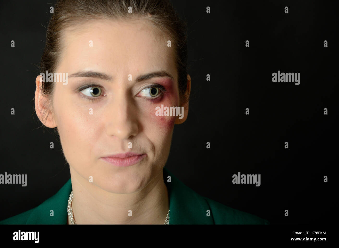 Home violence. Portrait of beaten woman with injuries on face, bleeding ...
