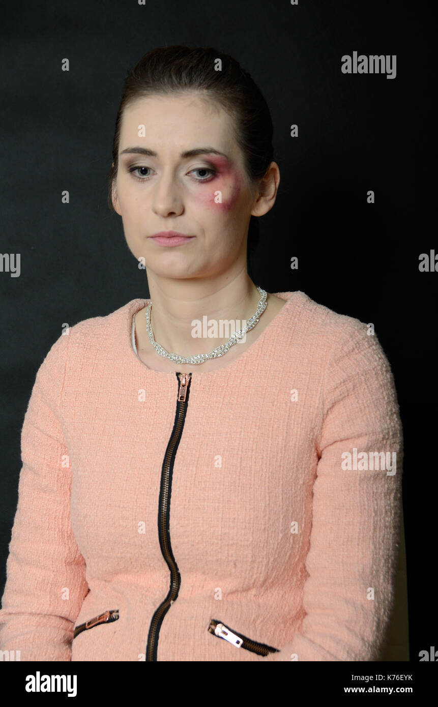 Home violence. Beaten woman with injuries on face, bleeding, black eye ...