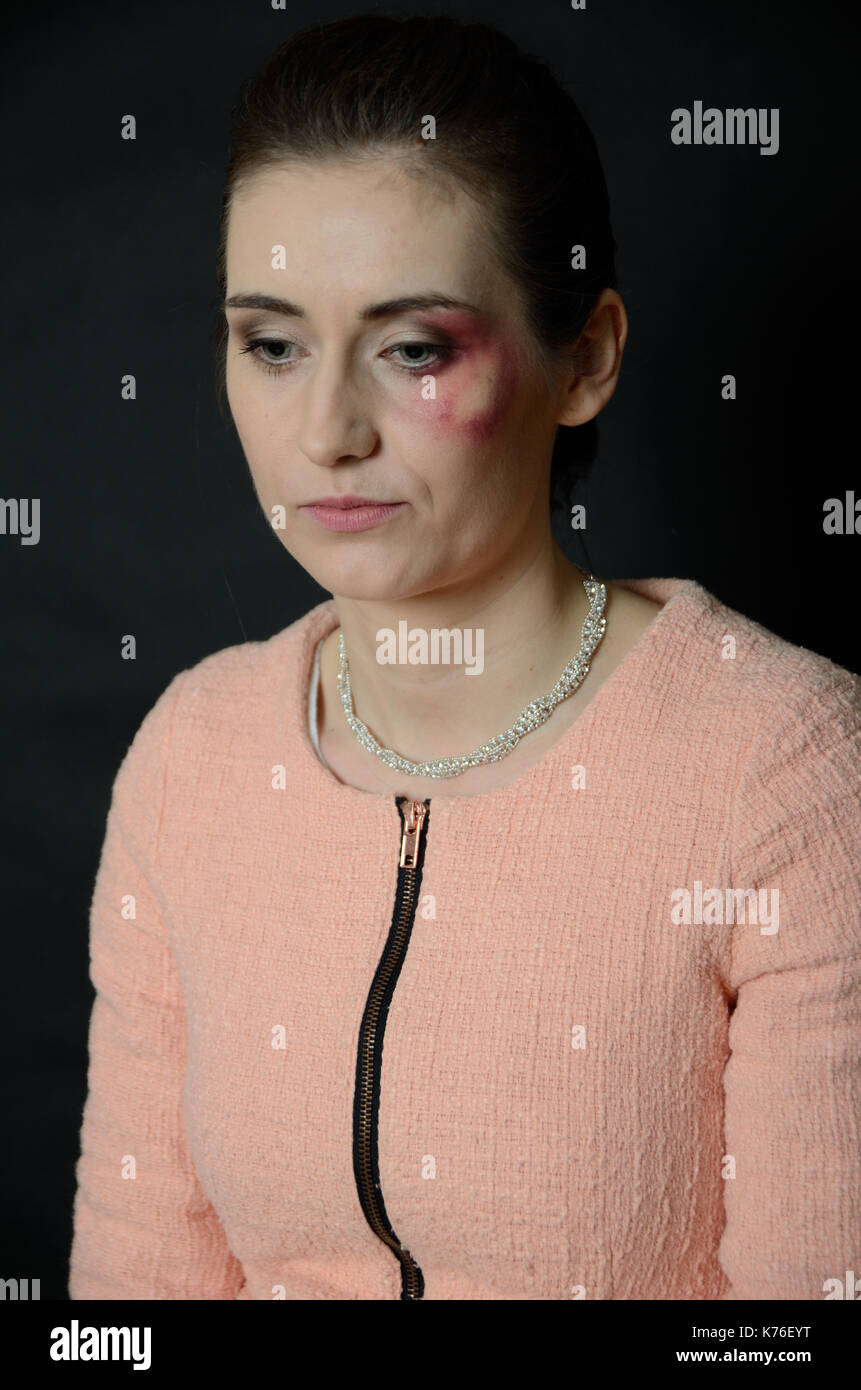 Home violence. Beaten woman with injuries on face, bleeding, black eye ...