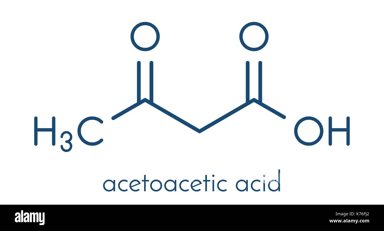 Ketone body (acetoacetic acid, diacetic acid) molecule. Skeletal ...