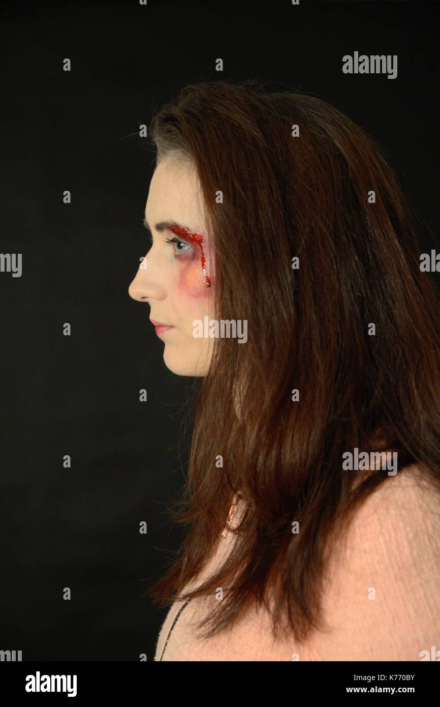 Home violence. Beaten woman with injuries on face, bleeding, black eye ...