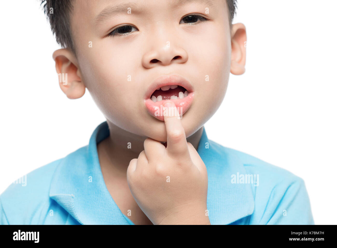 Lost milk tooth boy, Close up view Stock Photo - Alamy