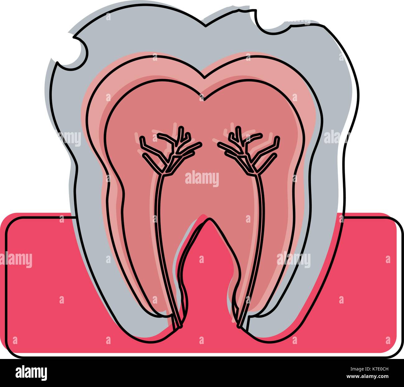 Molar Tooth Stock Photos & Molar Tooth Stock Images - Alamy