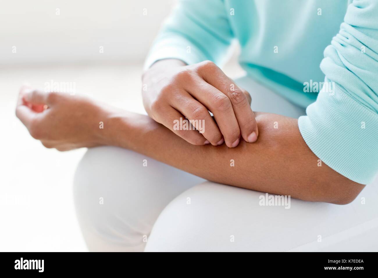Woman scratching arm Stock Photo - Alamy