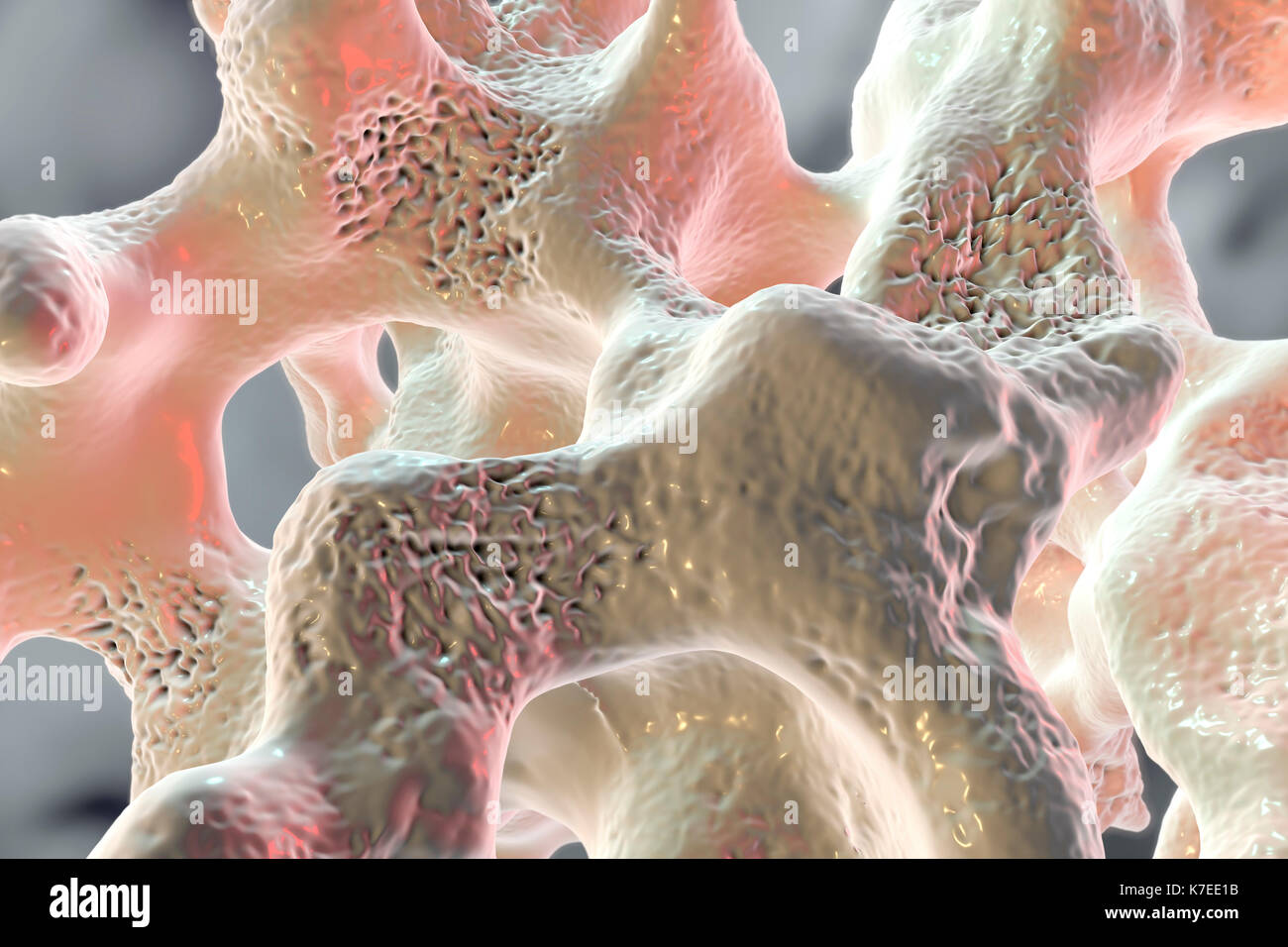 Thinning bone hi-res stock photography and images - Alamy