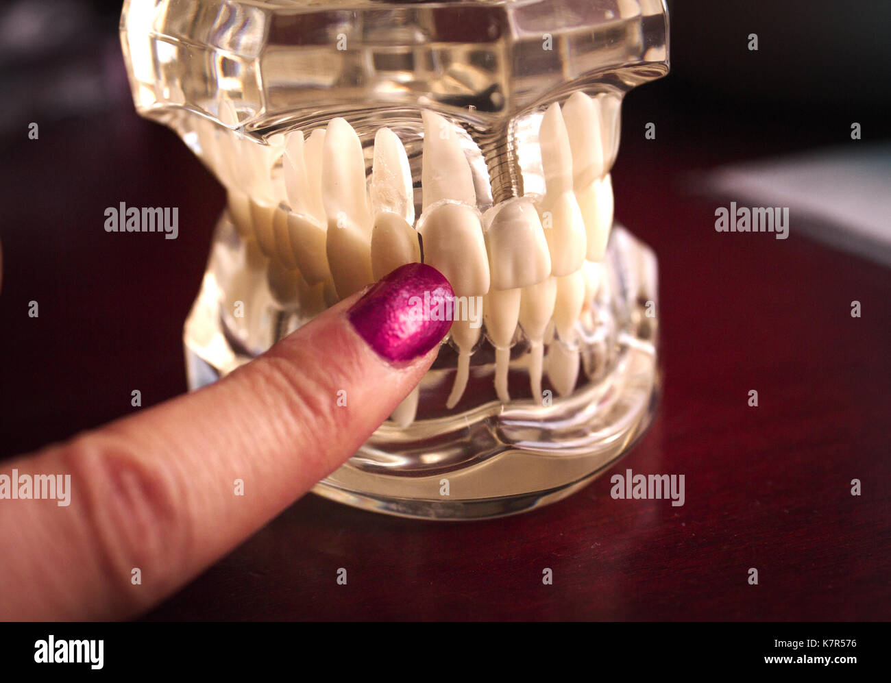 Denture pointed by fingers of woman Stock Photo - Alamy