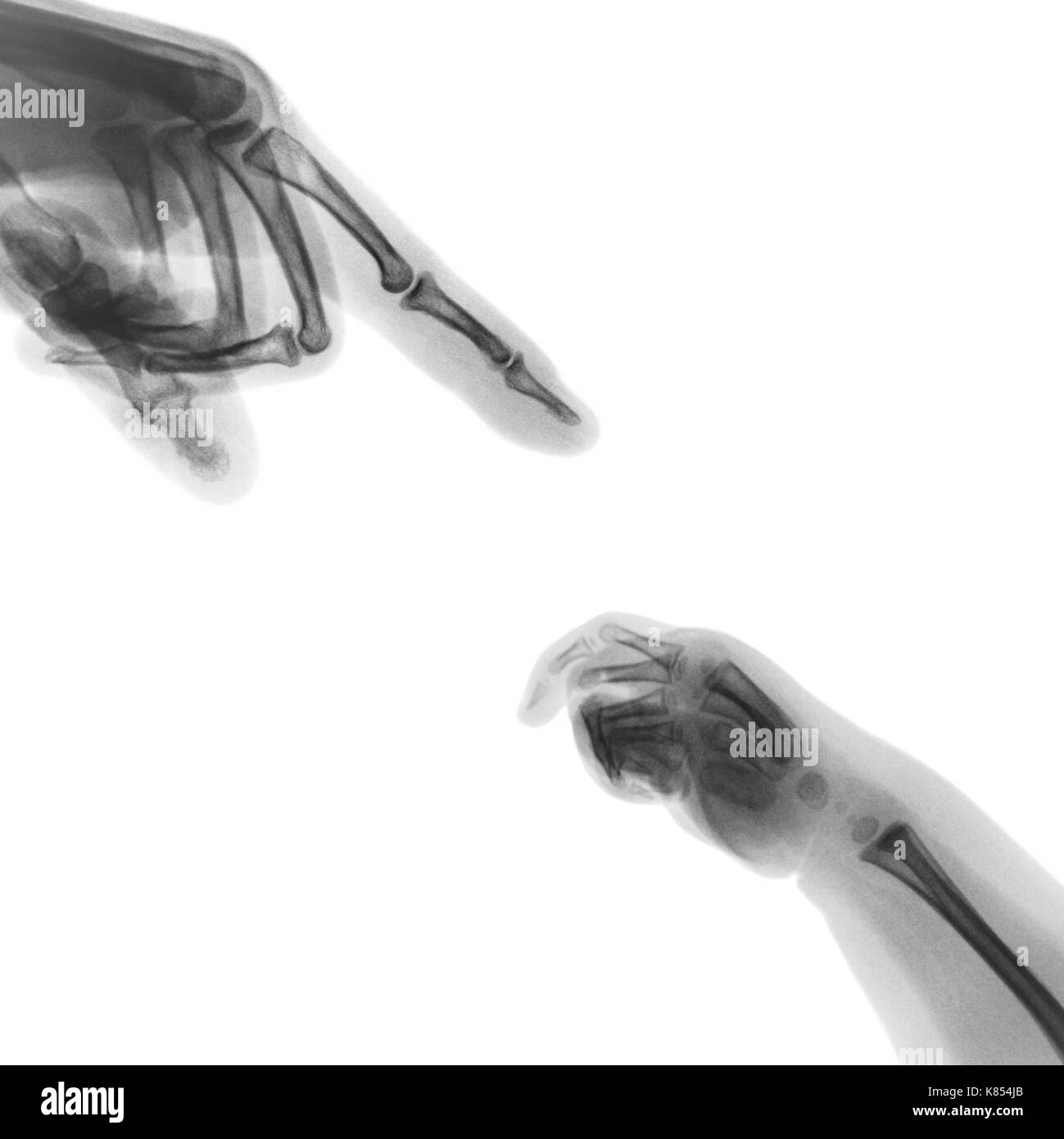 Lower arm bone hi-res stock photography and images - Alamy