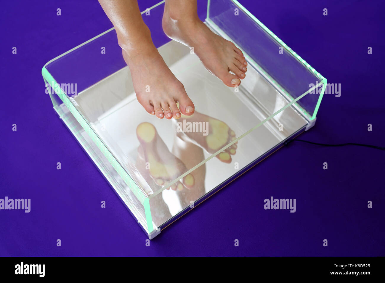 Female feet during a podoscopic examination in an orthopedic surgery ...