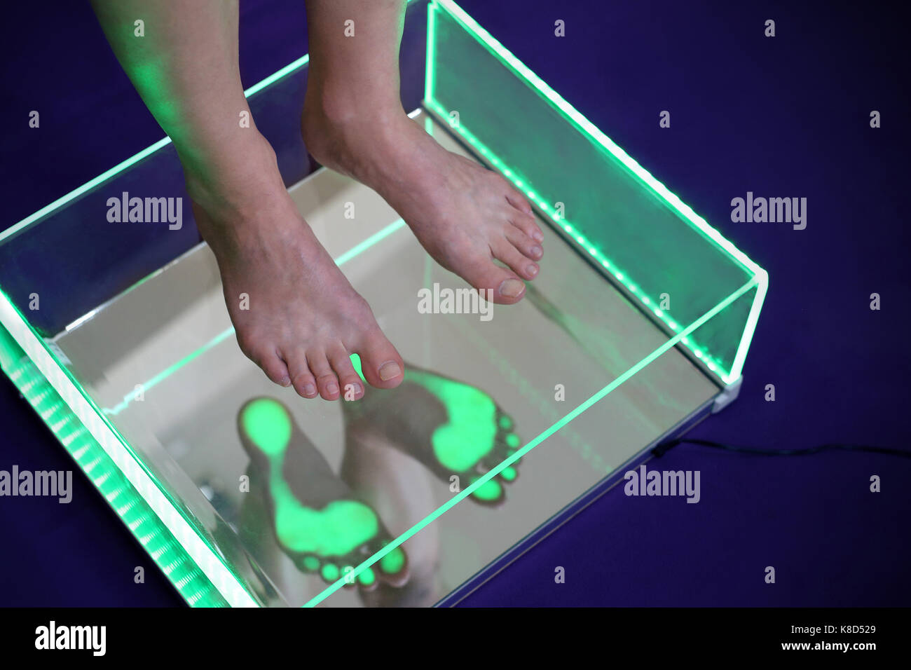 Female feet during a podoscopic examination in an orthopedic surgery ...