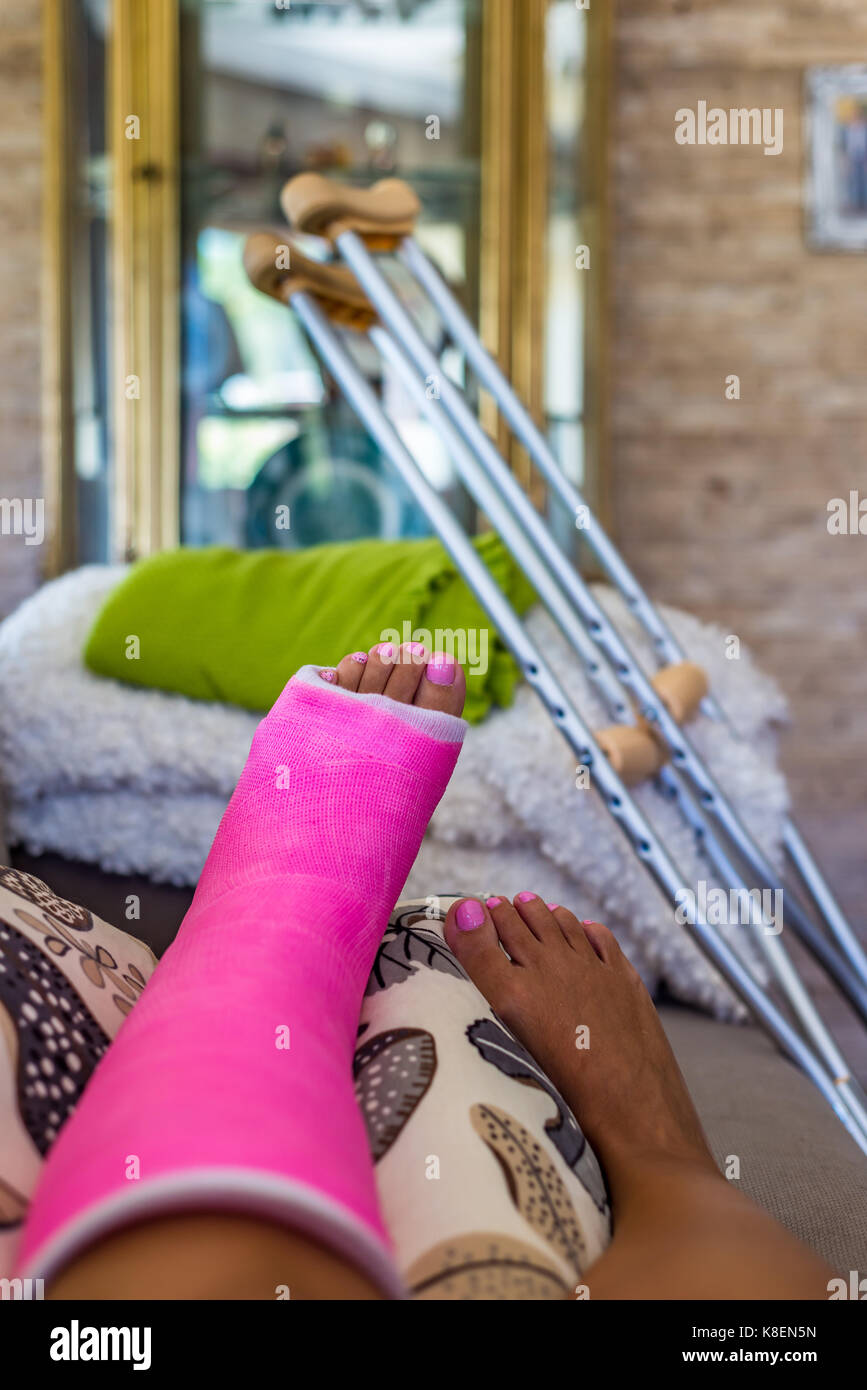 Woman with broken ankle High Resolution Stock Photography and Images ...