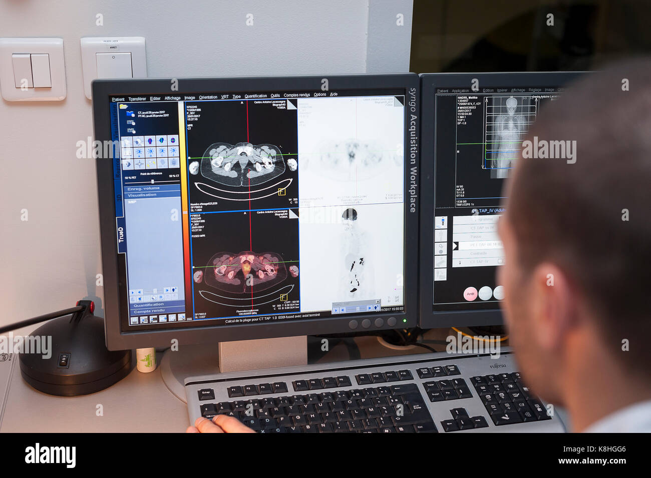 Nuclear medicine pet scan hi-res stock photography and images - Alamy