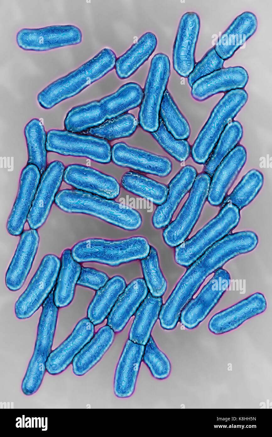 Enterobacteria hi-res stock photography and images - Alamy