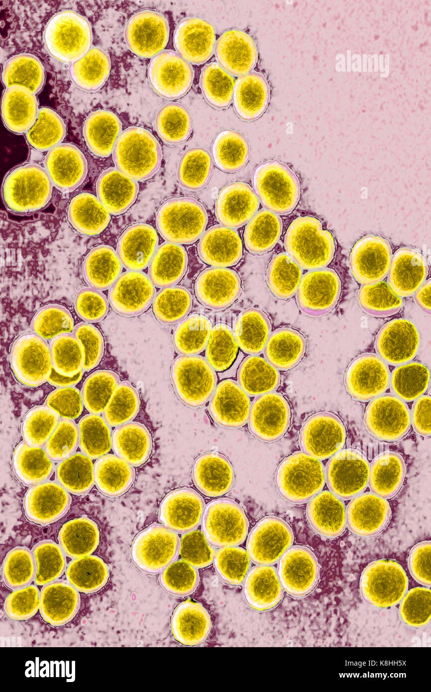 Staph aureus hi-res stock photography and images - Alamy