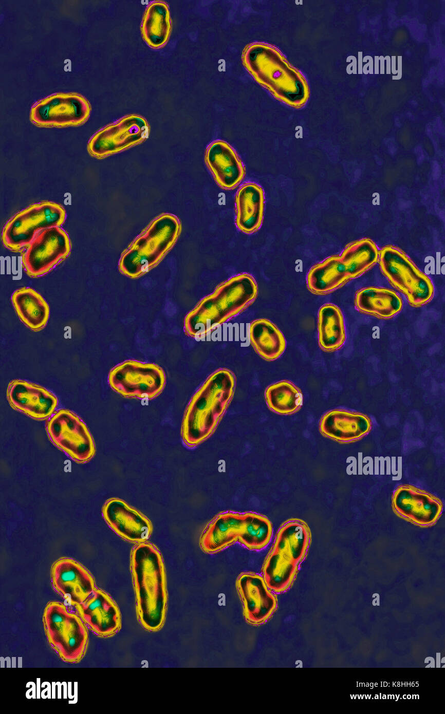 Yersinia pestis hi-res stock photography and images - Alamy