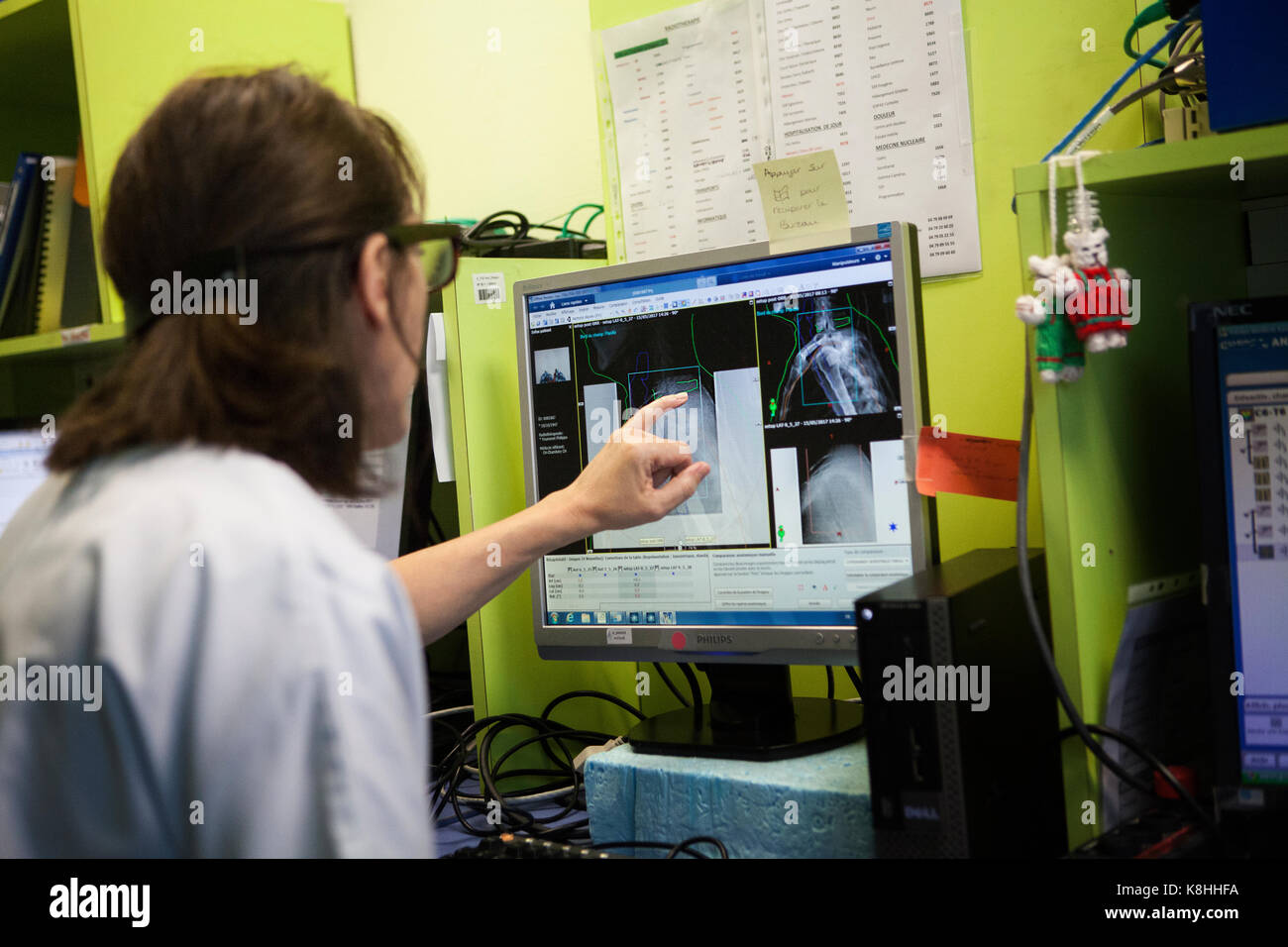 External beam radiotherapy hi-res stock photography and images - Alamy