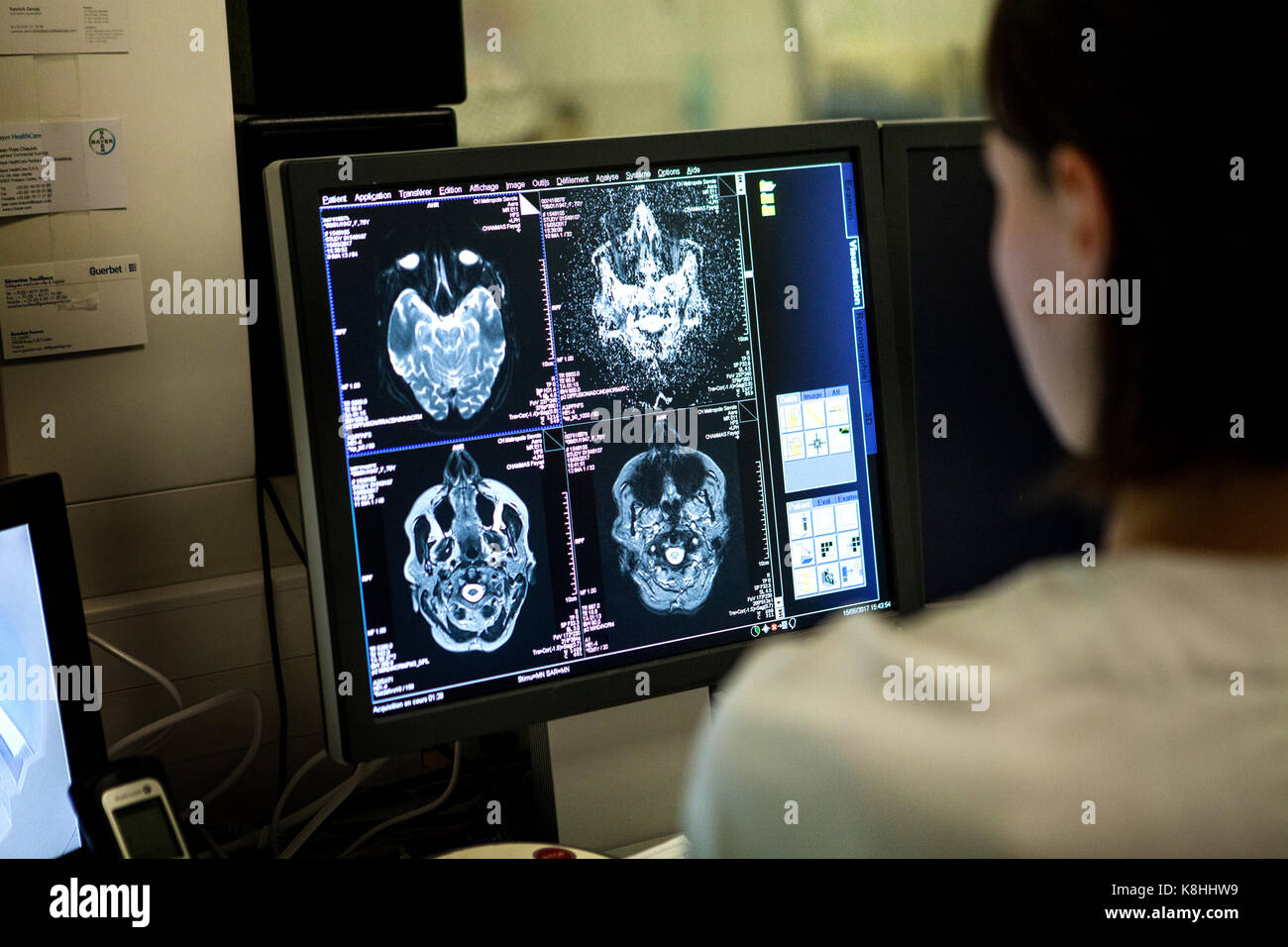 Mri examination hi-res stock photography and images - Alamy
