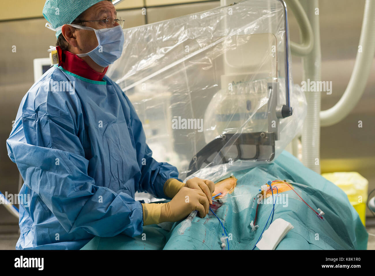Cardiac ablation hi-res stock photography and images - Alamy