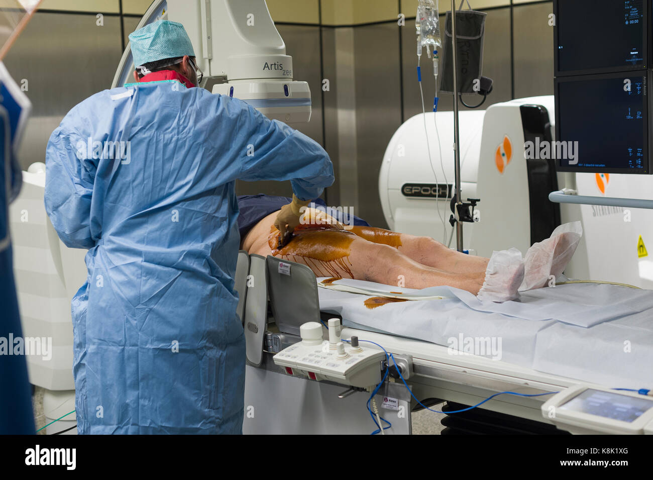 Cardiac ablation hi-res stock photography and images - Alamy