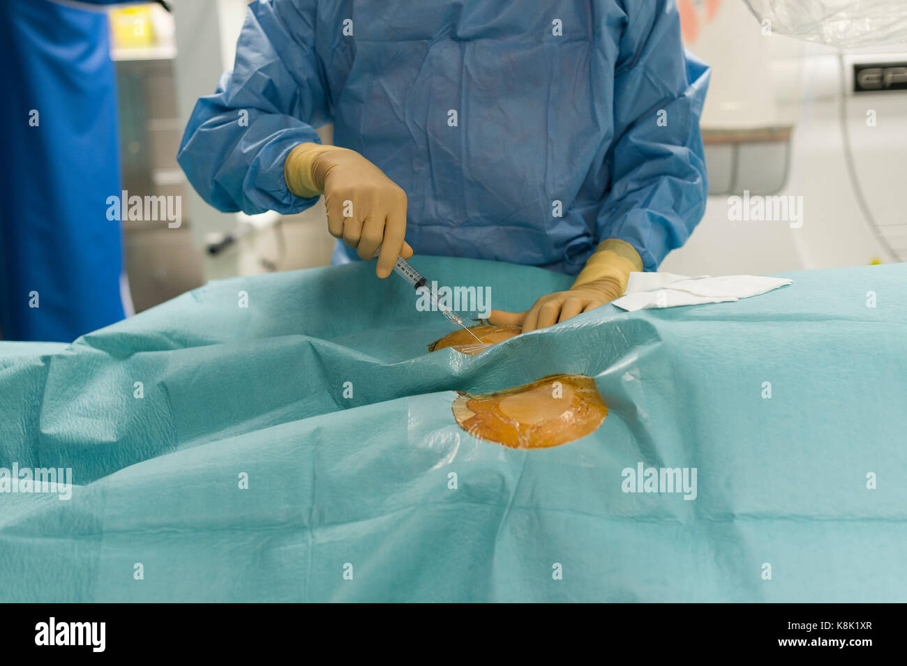 Atrial Fibrillation Ablation High Resolution Stock Photography and ...