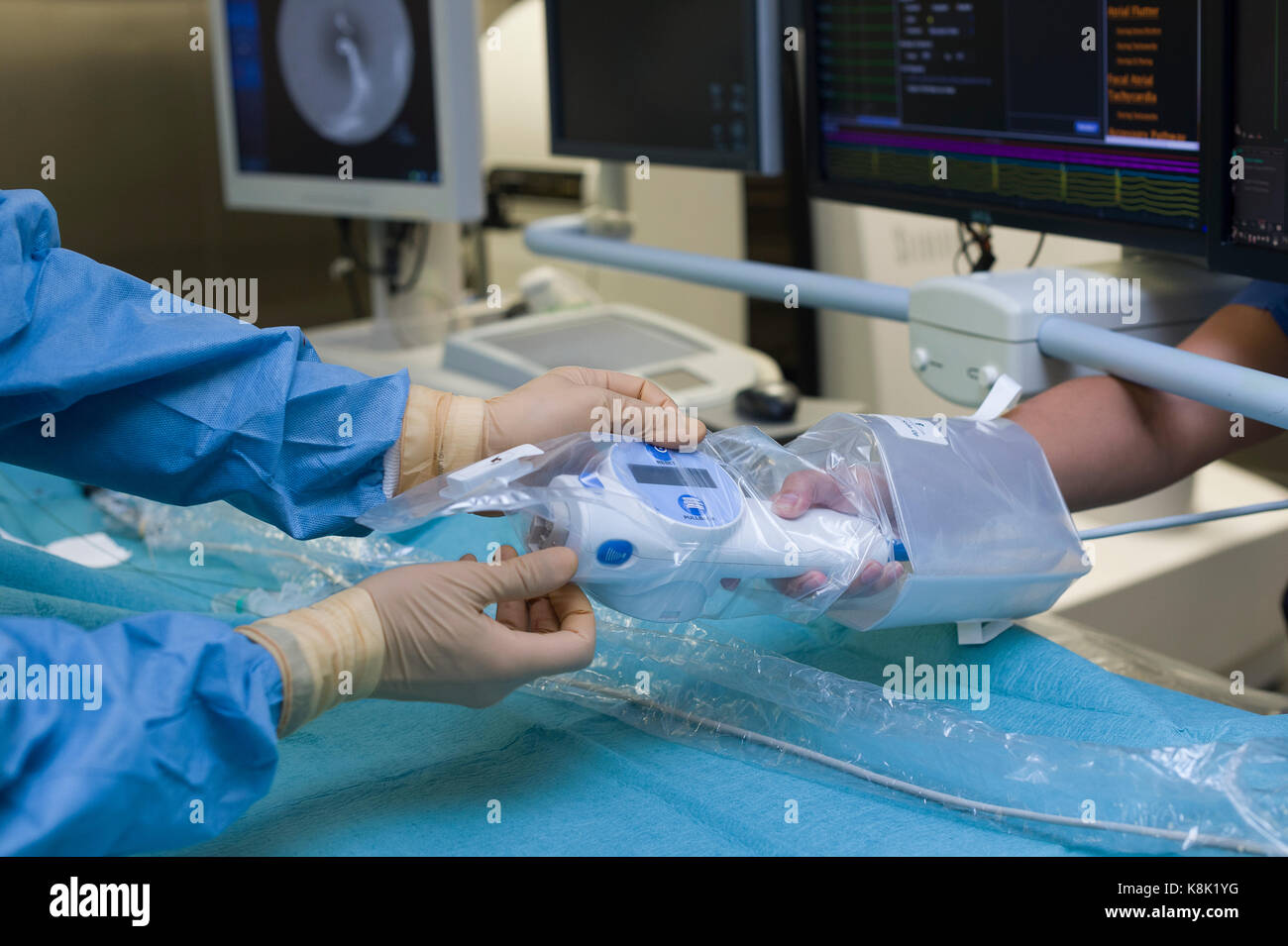 Cardiac ablation hi-res stock photography and images - Alamy