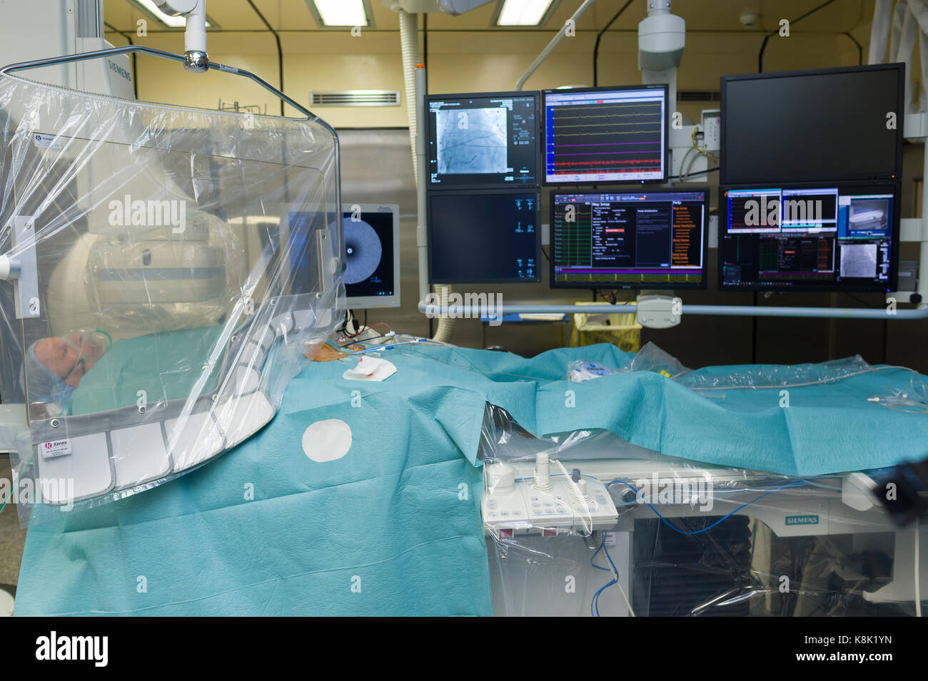 Atrial fibrillation ablation hi-res stock photography and images - Alamy