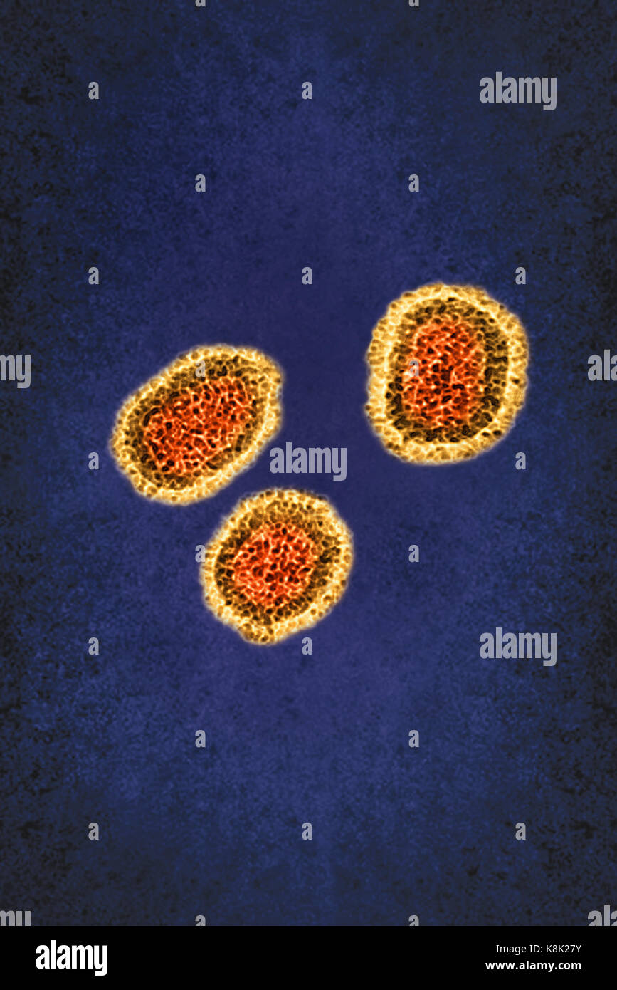 INFLUENZA VIRUS, TEM Stock Photo - Alamy