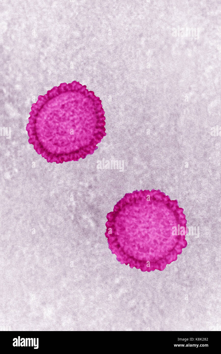 INFLUENZA VIRUS, TEM Stock Photo - Alamy INFLUENZA VIRUS, TEM Stock Photo - Alamy
