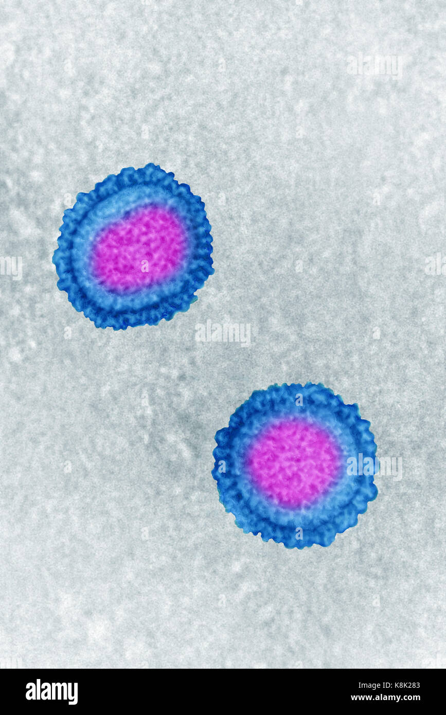 INFLUENZA VIRUS, TEM Stock Photo - Alamy