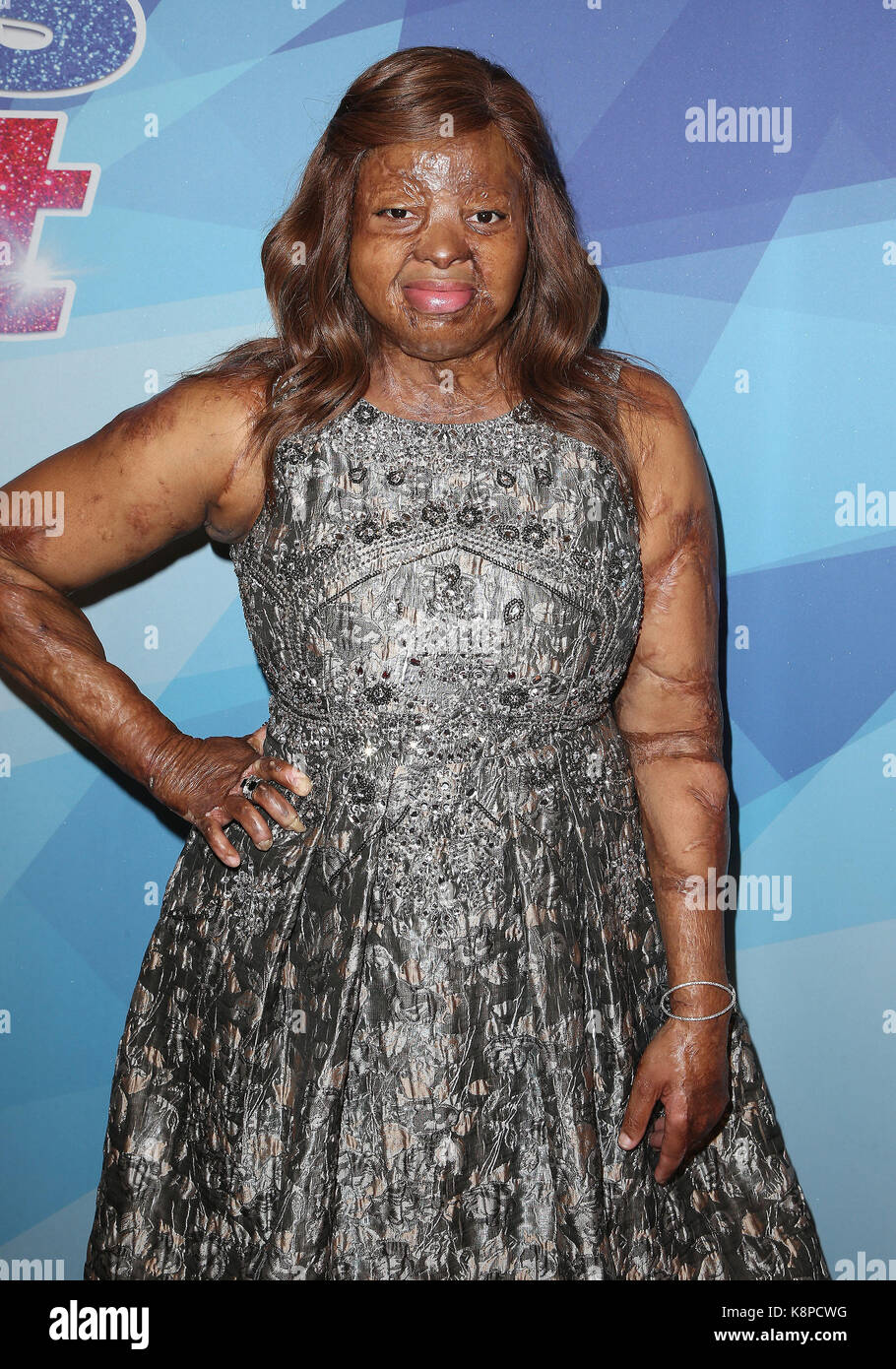 19 September 2017 - Hollywood, California - Kechi. NBC "America's Got ...