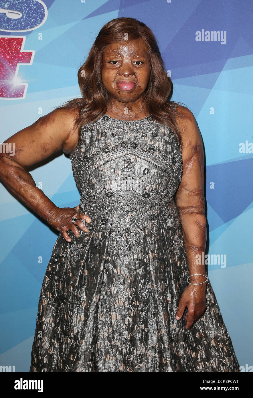 19 September 2017 - Hollywood, California - Kechi. NBC "America's Got ...