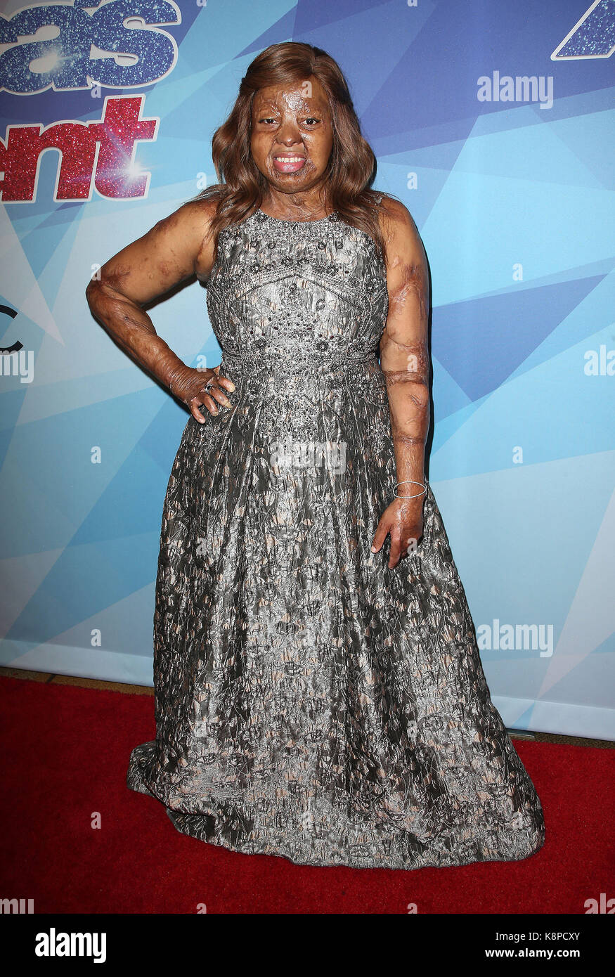 19 September 2017 - Hollywood, California - Kechi. NBC "America's Got ...
