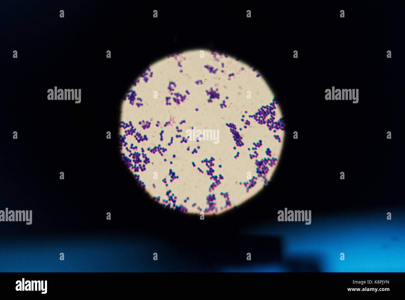 Mrsa microscope hi-res stock photography and images - Alamy