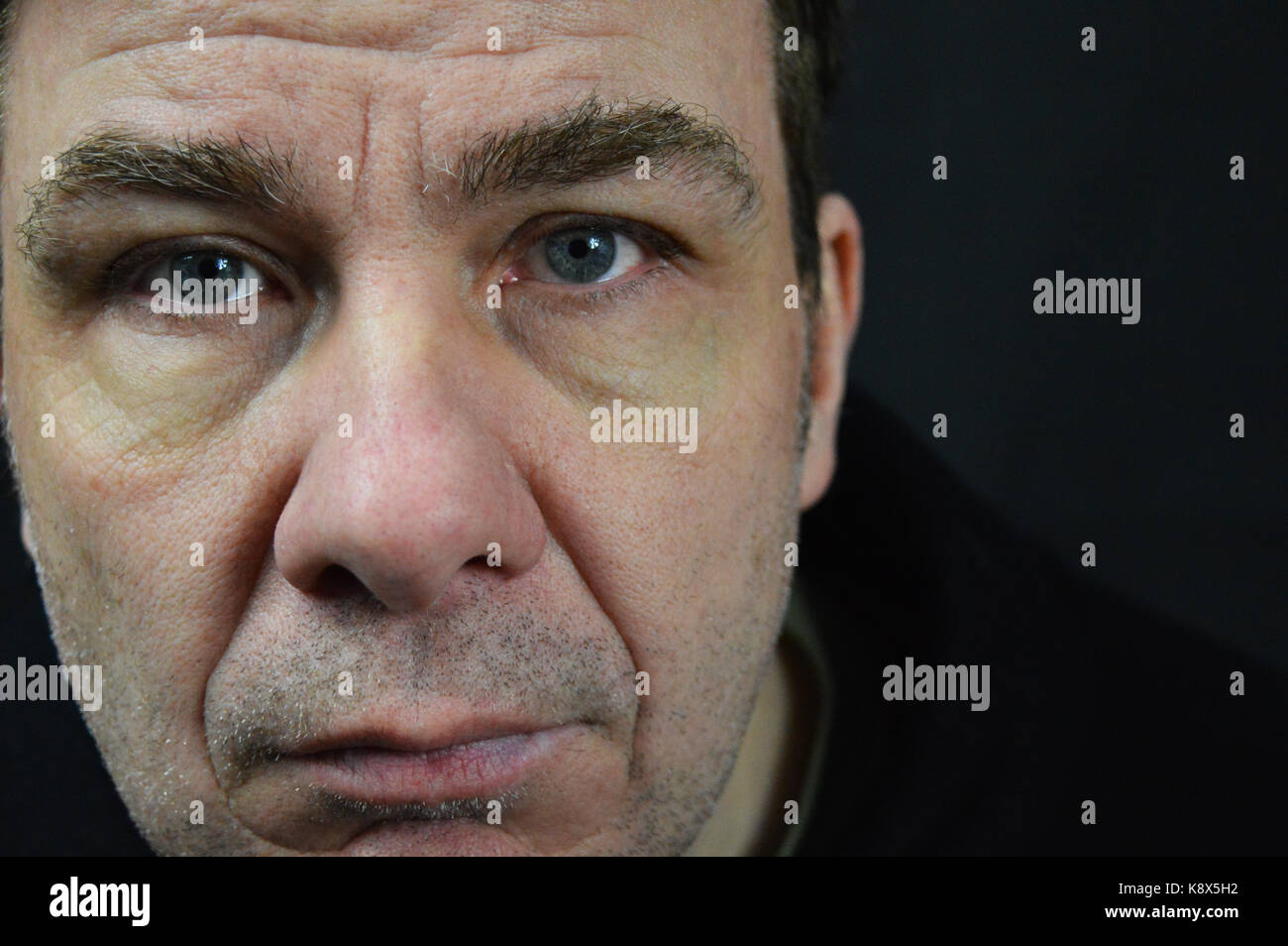 Man suffering depression Stock Photo - Alamy