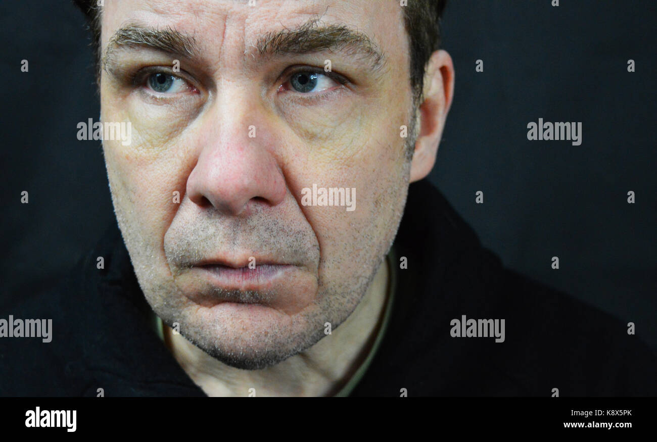 Man suffering depression Stock Photo - Alamy