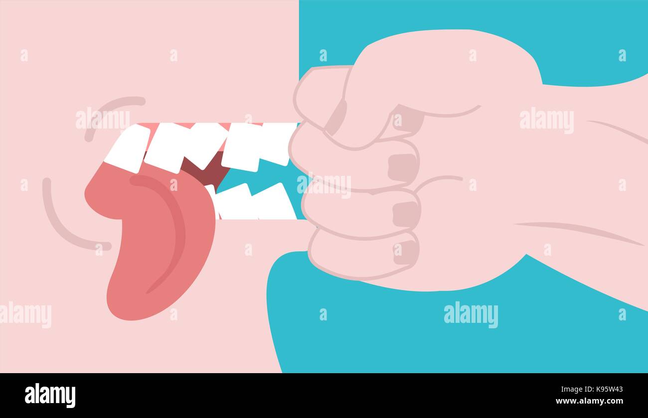Punch in the teeth hi-res stock photography and images - Alamy