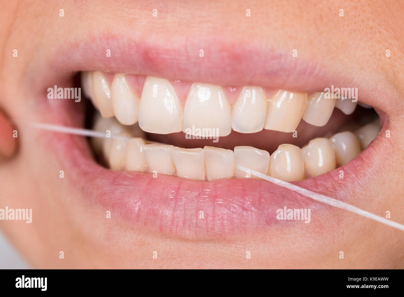 Close-up Photo Of A Woman Flossing Teeth Stock Photo - Alamy
