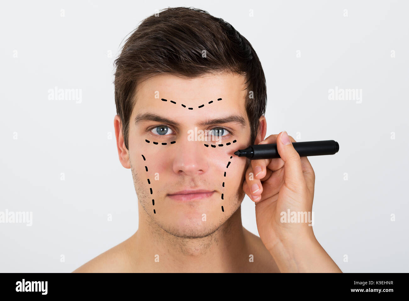 Close-up Of Person Hands Making Lines With Pen On Face Of Young Man ...