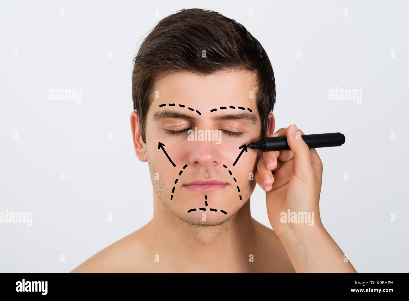 Close-up Of Person Hands Making Lines With Pen On Face Of Young Man ...