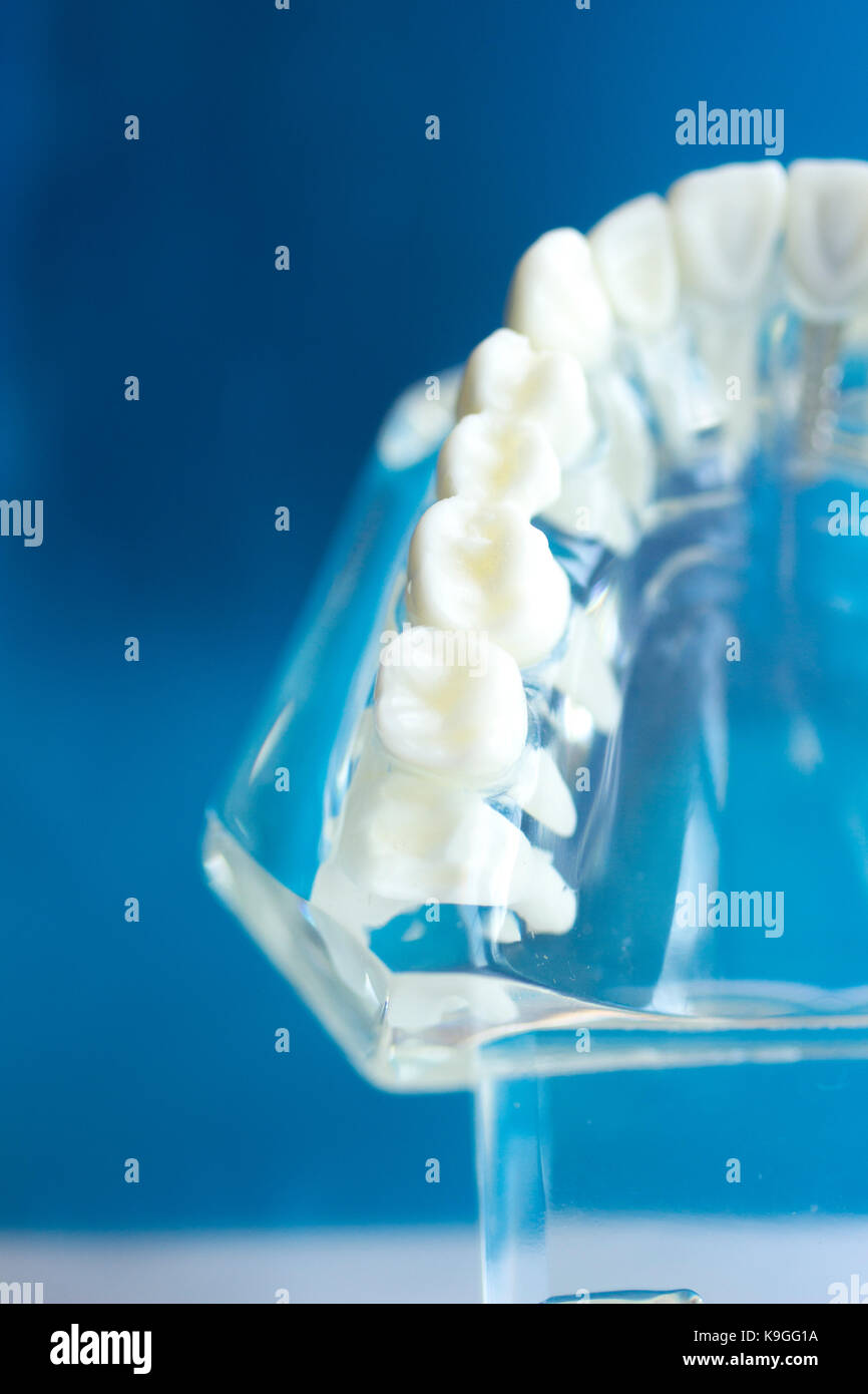 Dental teeth mouth dentists teaching model with teeth, gums, molars and ...