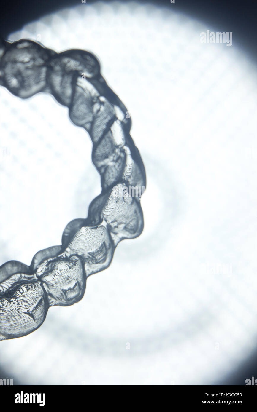 Invisible teeth retainers orthodontic brackets. Plastic modern ...