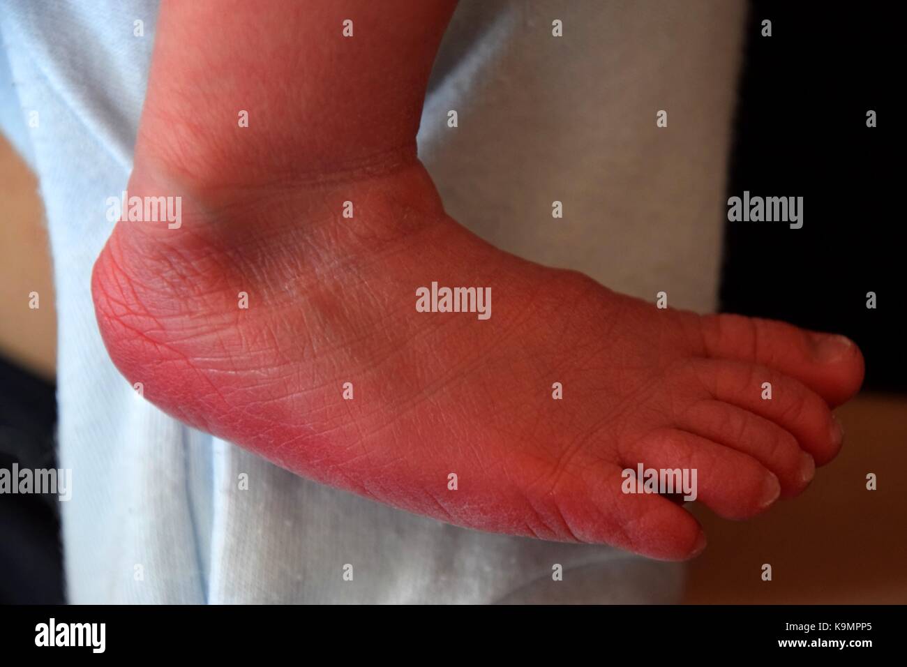 newborn Baby Boy, brand-new Baby, neonate, Little and tiny ear and head ...