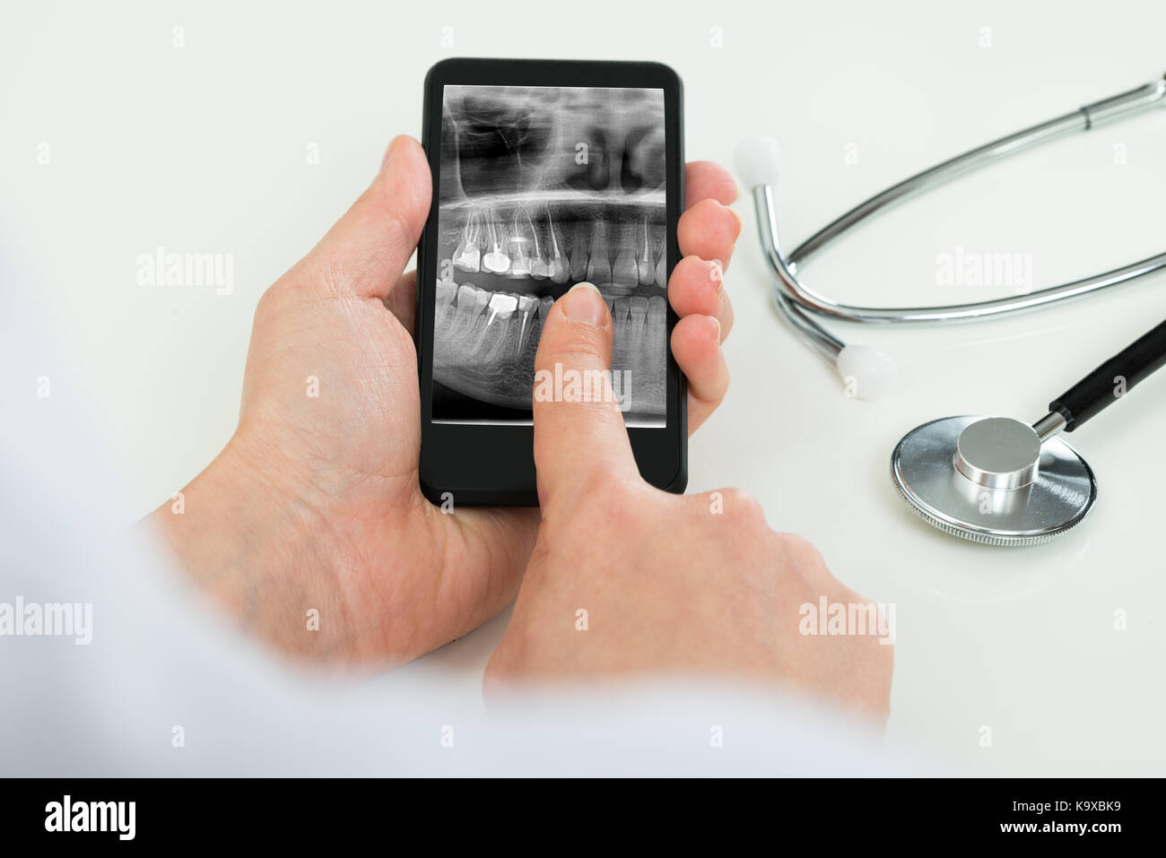 Close-up Of Person Hand With Mobile Phone Showing Dental X-ray Film ...